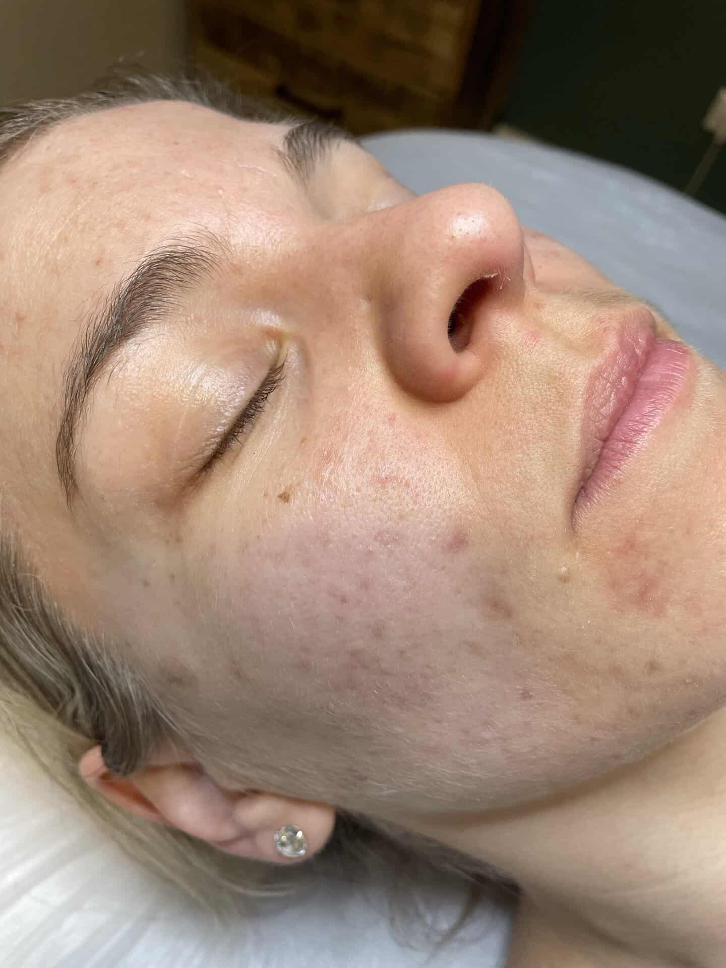 From Reactive Skin to Radiance: A SAPEDA Client Transformation Story